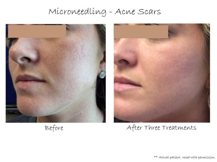 DSCS Derm | Before and After